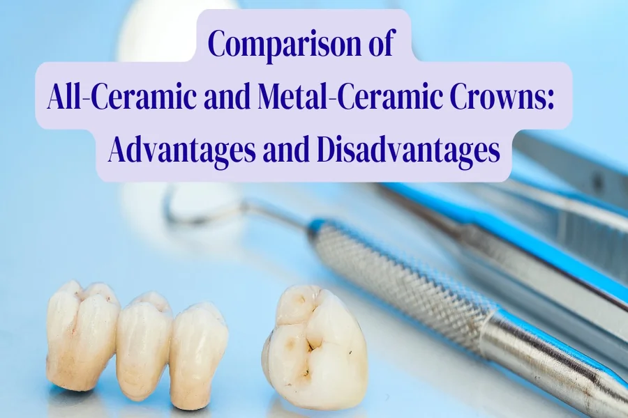 Exploring The Benefits Of All Ceramic Vs Metal Ceramic Crowns